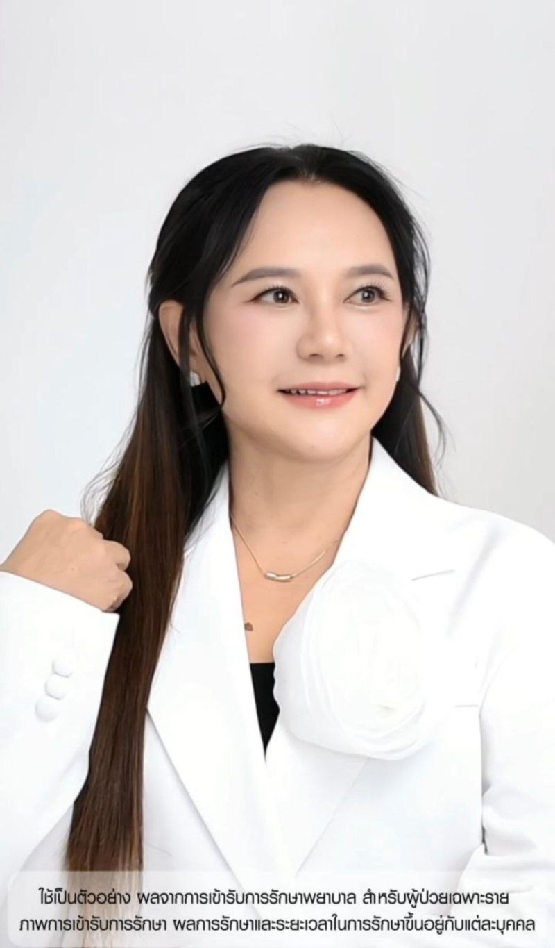 ภาพล่าสุด แหม่ม จินตหรา หลังทำศัลยกรรมในวัย 60 ครบ 1 เดือน ละมุนมาก