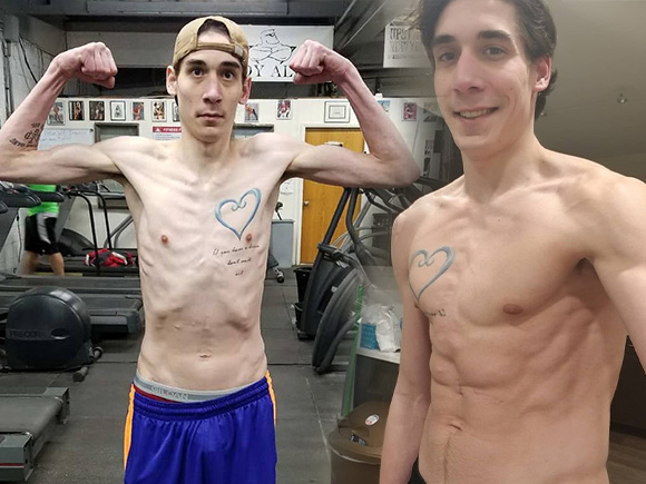 หนุ่มผอมป่วยโรคปอดใช้เวลา 8 เดือน บิ้วต์กล้ามสู่นักเพาะกายอาชีพ