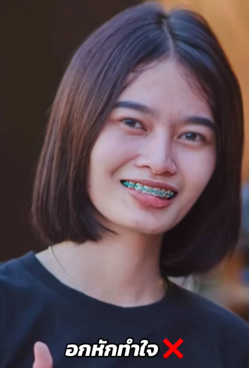 น้ำแข็ง ทิพวรรณ เปิดภาพก่อนและหลังศัลยกรรม สวยจึ้งกว่าเดิม