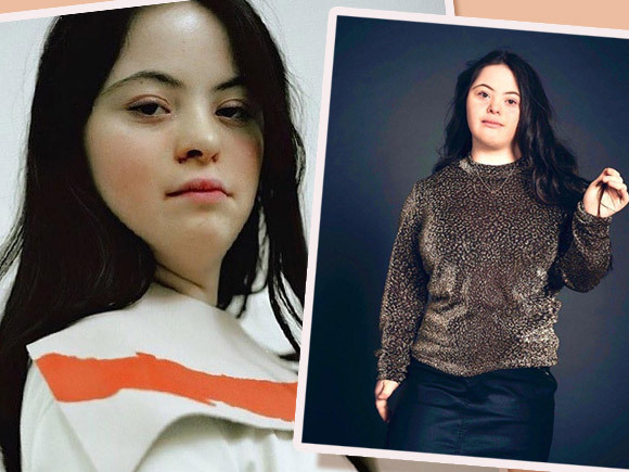 ความคิดเห็น เฟียร์ซเว่อร์ ! Ellie Goldstein นางแบบดาวน์ซินโดรมคนแรกของ ...